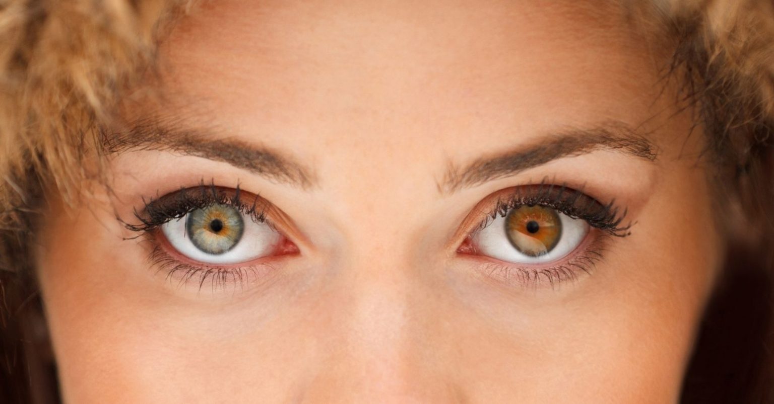 Different-Coloured Eyes: Learning More About Heterochromia - BizTech Times